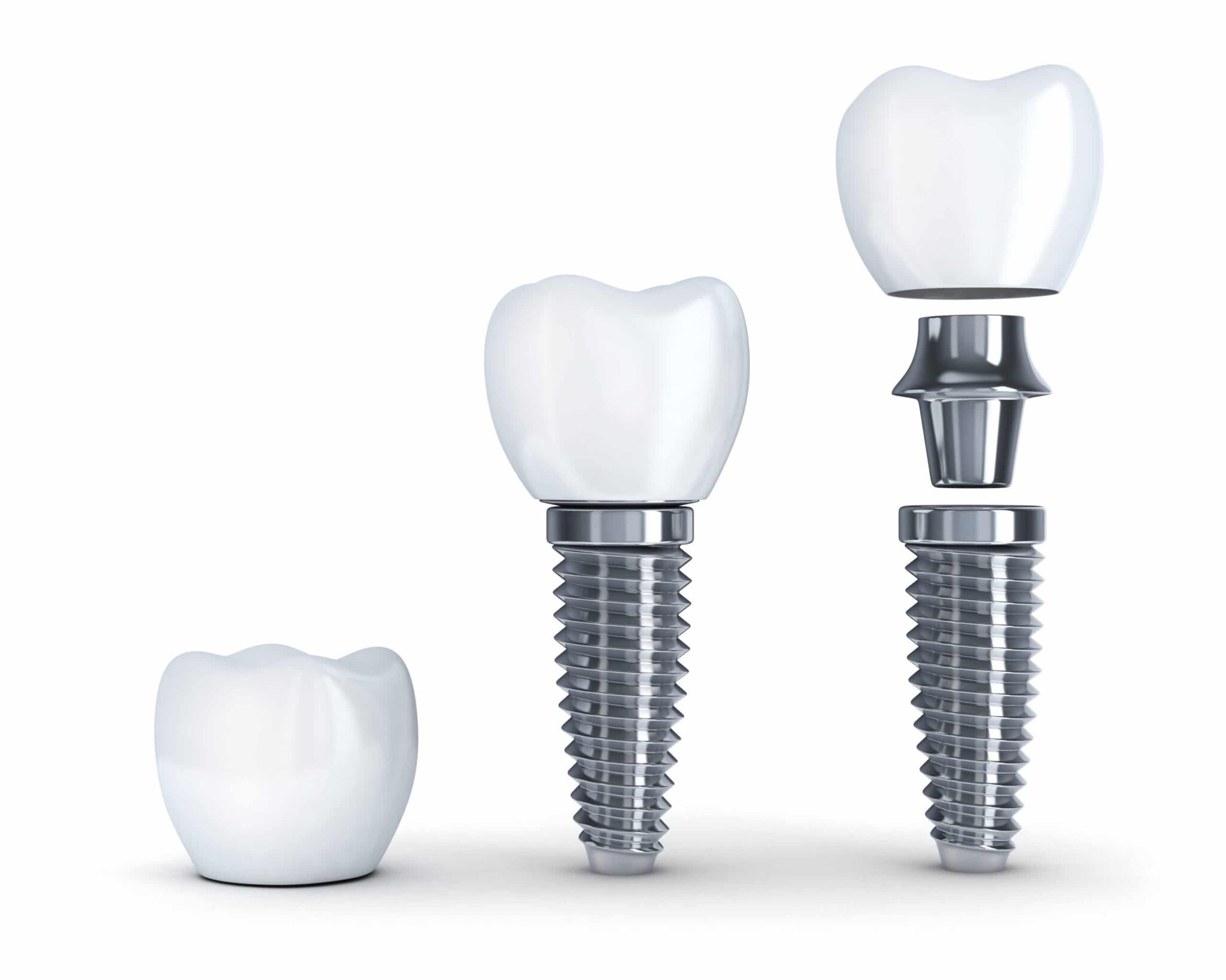 Nobel Biocare Dental Implants | Sydney Implant Institute